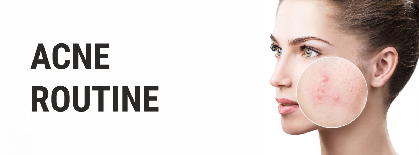 ACNE ROUTINE: AM AND PM CARE - silvergate.bio